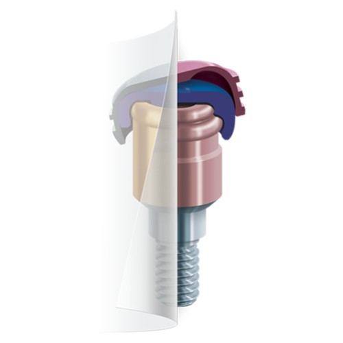 Présentation du LOCATOR RTX | Sodimed attachements implantaires accessoires